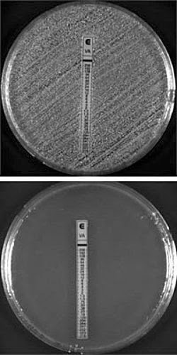 抗生素介紹 Part IV：戰勝超級細菌 MRSA 的新抗生素 - 科學，就是醬